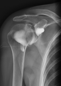 Arthroscanner et arthro IRM - RDV en ligne