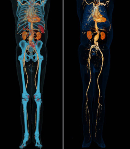 Scanner - RDV en ligne