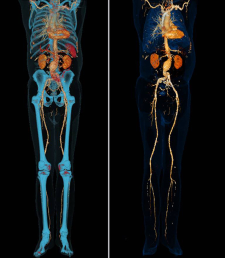 Scanner - RDV en ligne