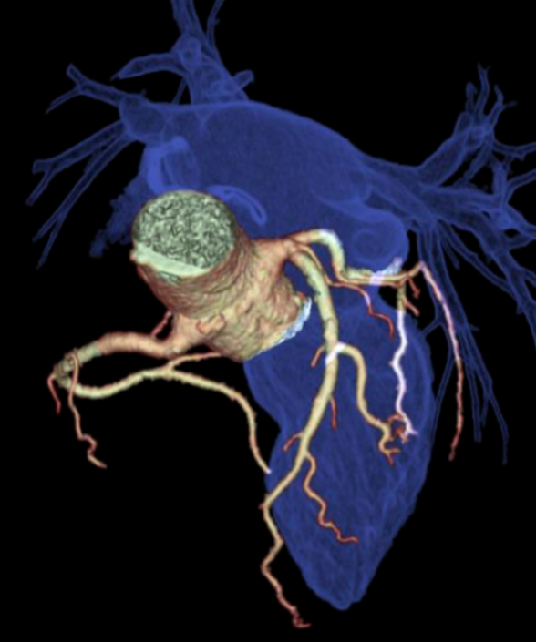 Coroscanner - RDV en ligne